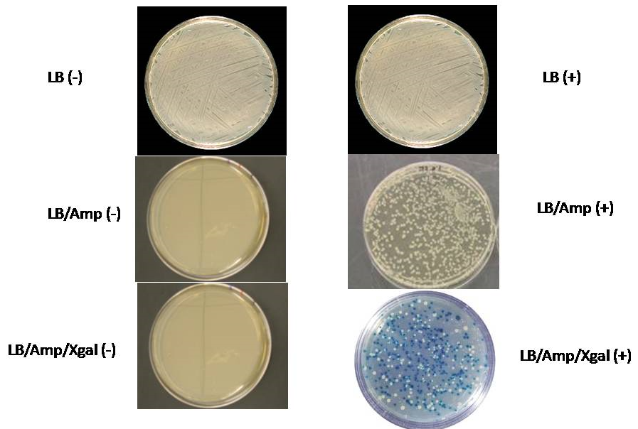 Solved Did you get growth on the -LB/AMP plate? Why or why | Chegg.com