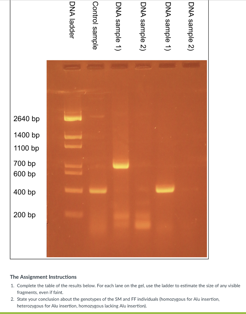 DNA ladder Control sample DNA sample 1) DNA sample 2) | Chegg.com