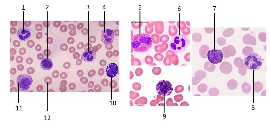 Solved Identify and label the different types of Leukocytes | Chegg.com