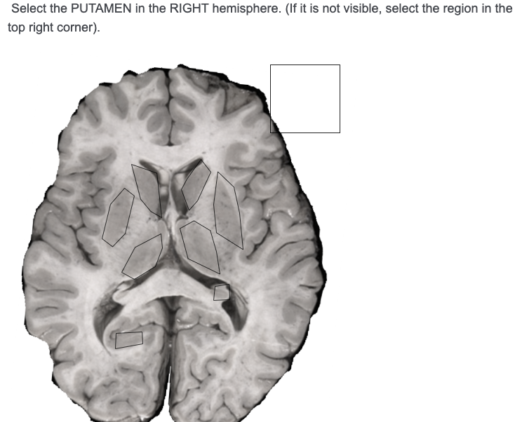 Solved Select the PUTAMEN in the RIGHT hemisphere. (If it is | Chegg.com
