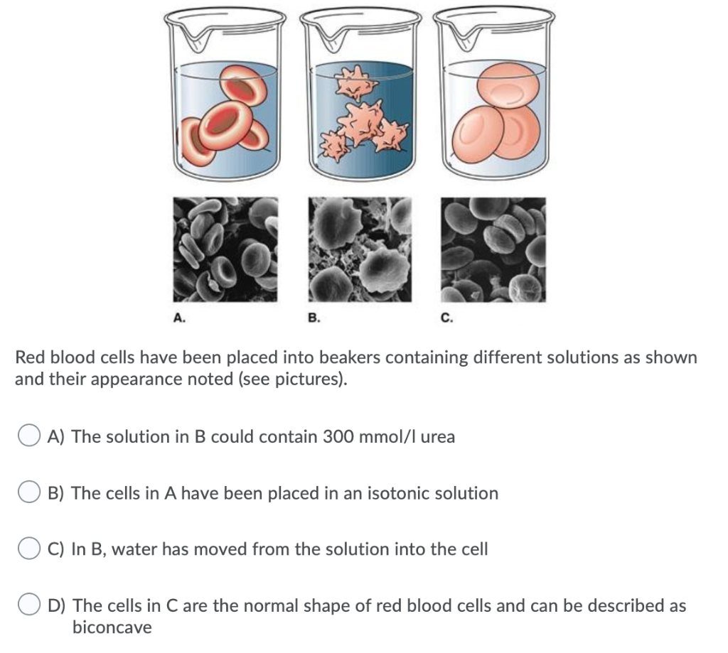 Solved A. B. C. Red blood cells have been placed into | Chegg.com