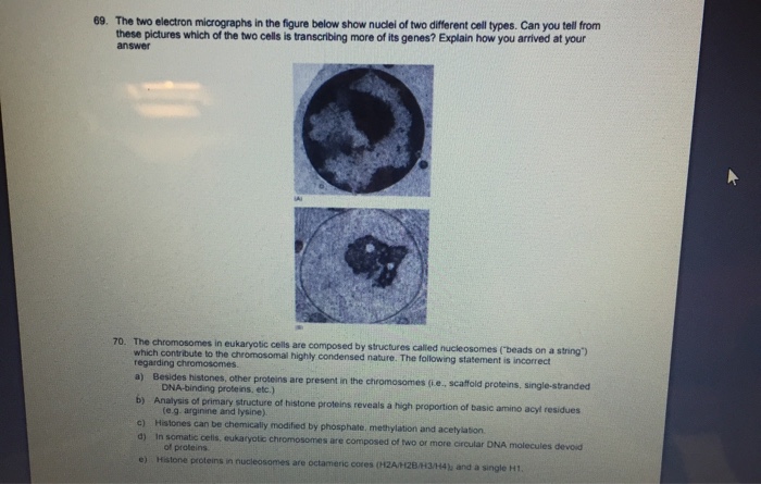 Solved 69. The two electron micrographs in the figure below | Chegg.com