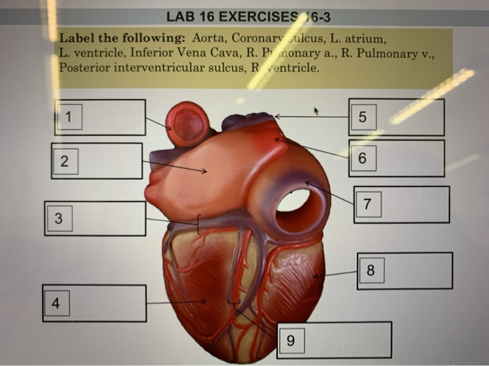 Solved entricular erior vena Label the following: Aorta, | Chegg.com