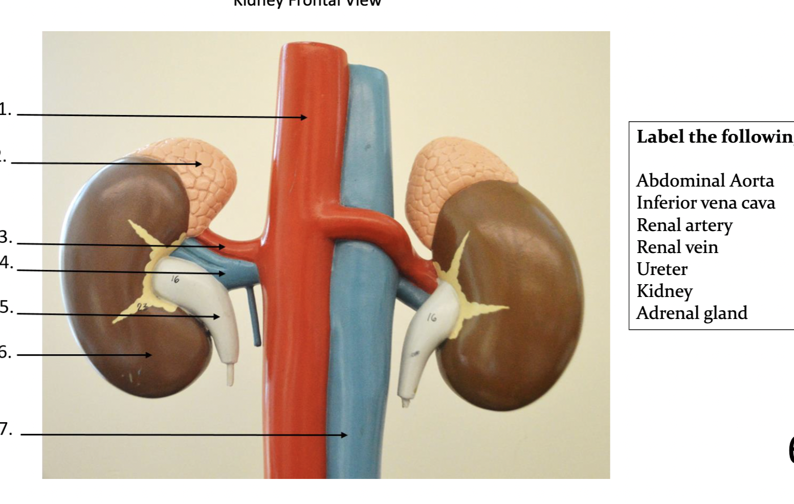 Solved Kidney Lateral View Vidnn, Crontal Dlonn I atoml | Chegg.com