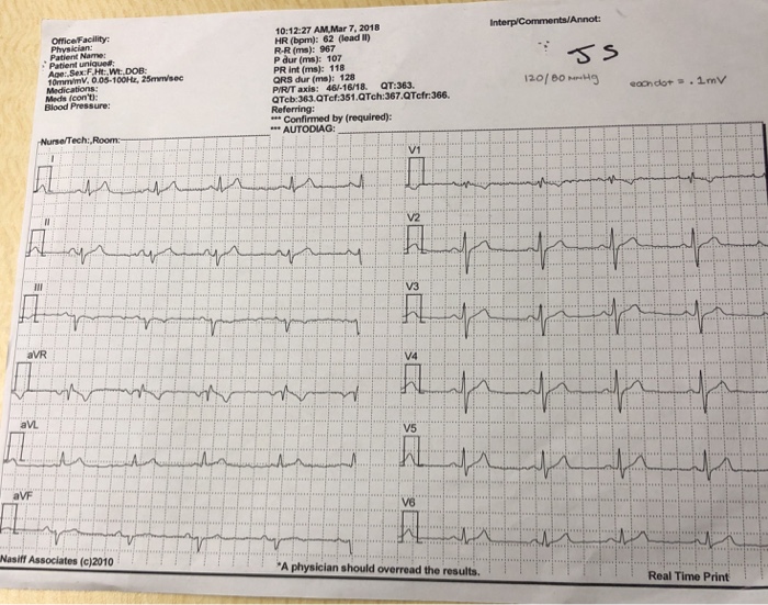 Solved On your this ECG, do you see any of the | Chegg.com