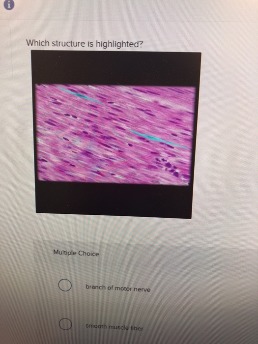 Solved Which structure is highlighted? Multiple Choice | Chegg.com