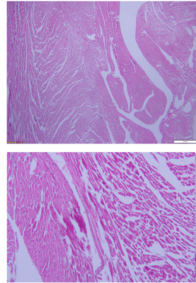 Solved This is 10X mag of a rats heart on a slide please | Chegg.com