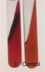 Solved For tube 3, describe the results of the Kligler Iron | Chegg.com