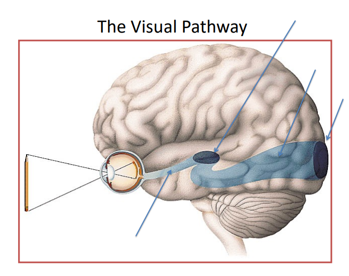 Solved The Visual Pathway | Chegg.com