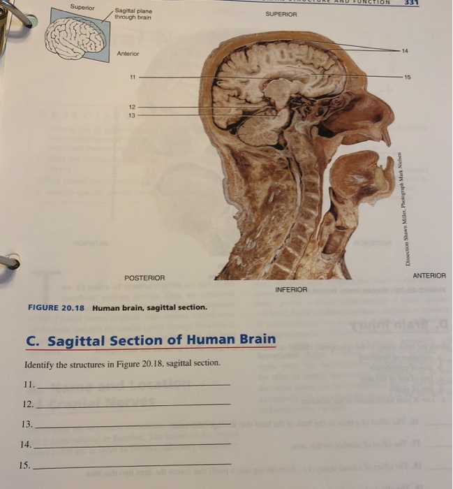 Solved FIGURE 20.16 Midsagittal section of the human brain | Chegg.com