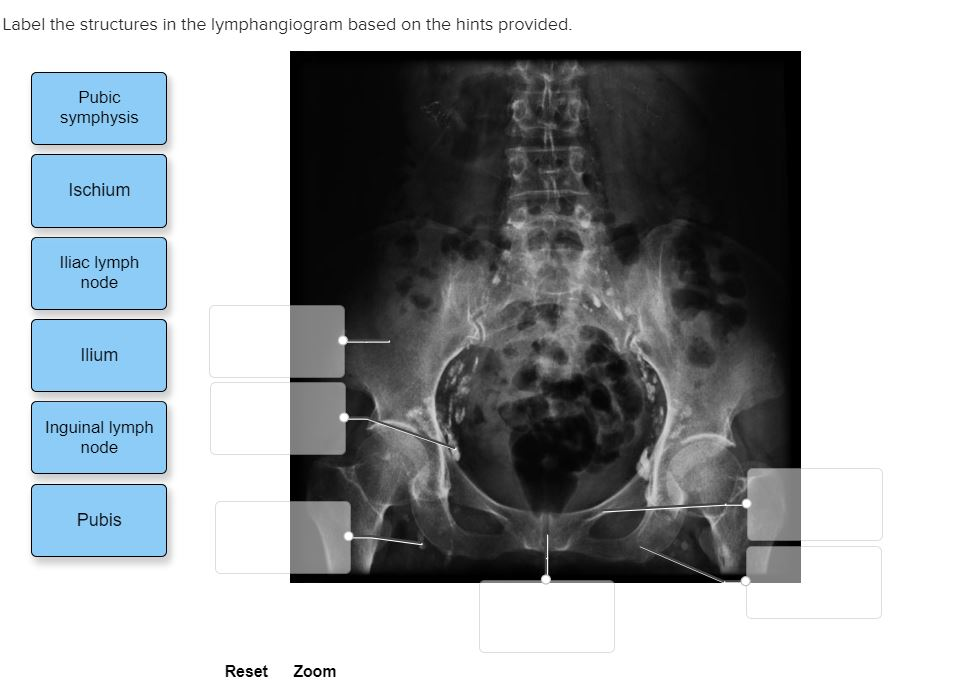 Solved Label the structures in the lymphangiogram based on | Chegg.com