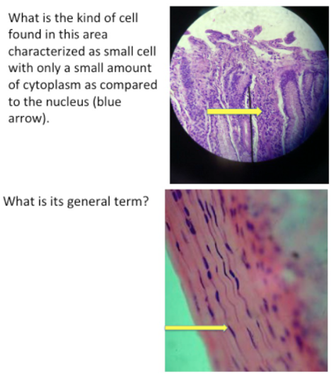 Solved • What do these cells' granules exhibit? Identify the | Chegg.com