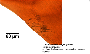 Solved 60 um IZ.000161.NM. Amphiporus imparispinosus | Chegg.com
