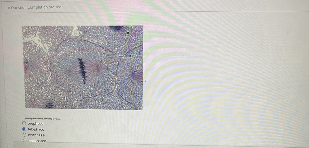 Solved This photomicrograph is of a cell undergoing mitosis, | Chegg.com
