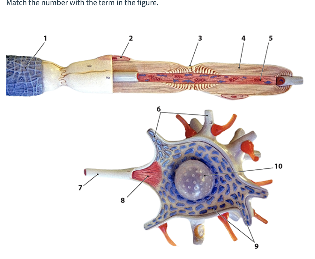 Solved Match the number with the term in the figure. 1 Axon | Chegg.com