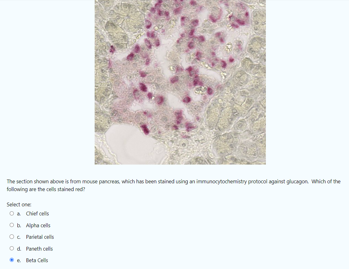 Solved The section shown above is from mouse pancreas, which | Chegg.com