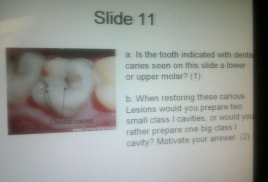 Solved Slide 13 In what direction is the axial wall of this | Chegg.com