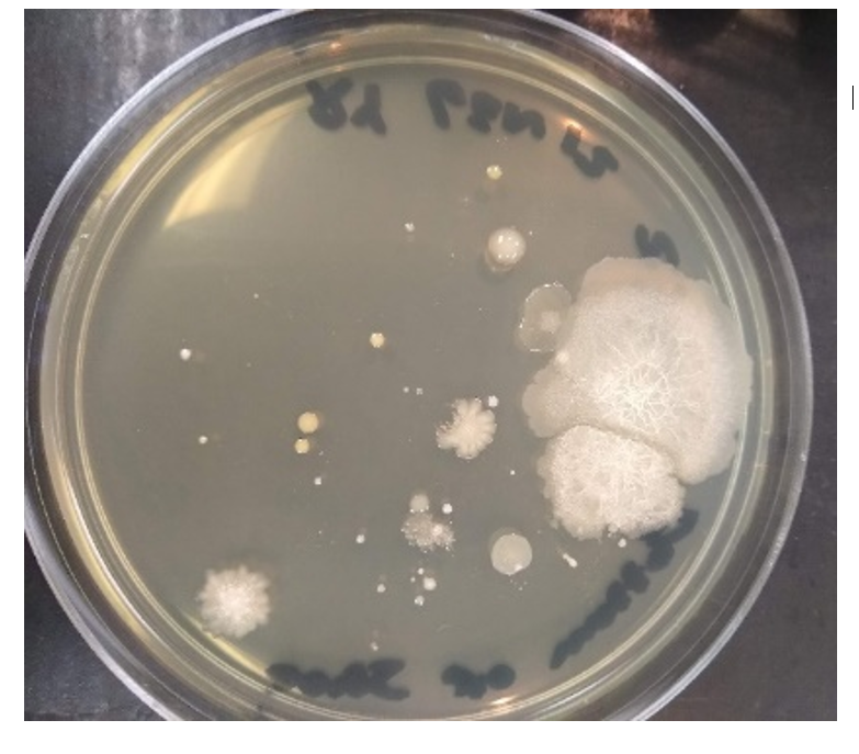 Solved 7. The TSA plate below was cultured with a sample | Chegg.com