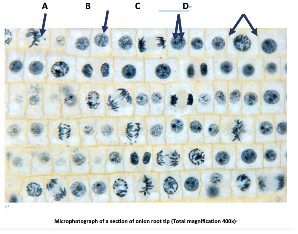 Solved Describe the shape of onion root tip cells shown at | Chegg.com