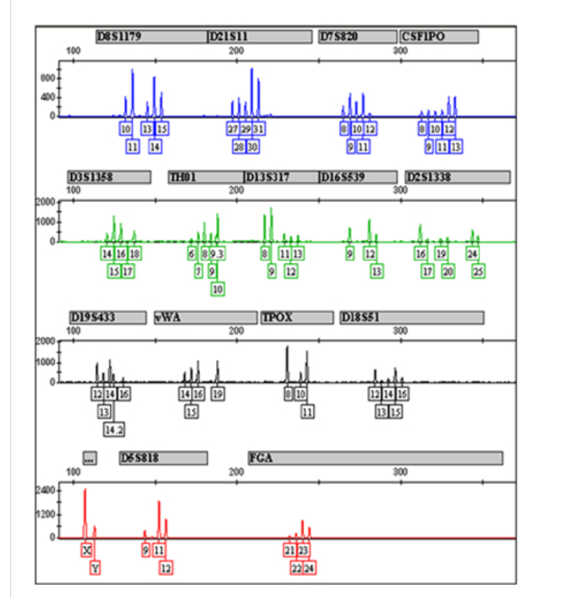 Solved Interpret the results of this DNA sample and explain | Chegg.com