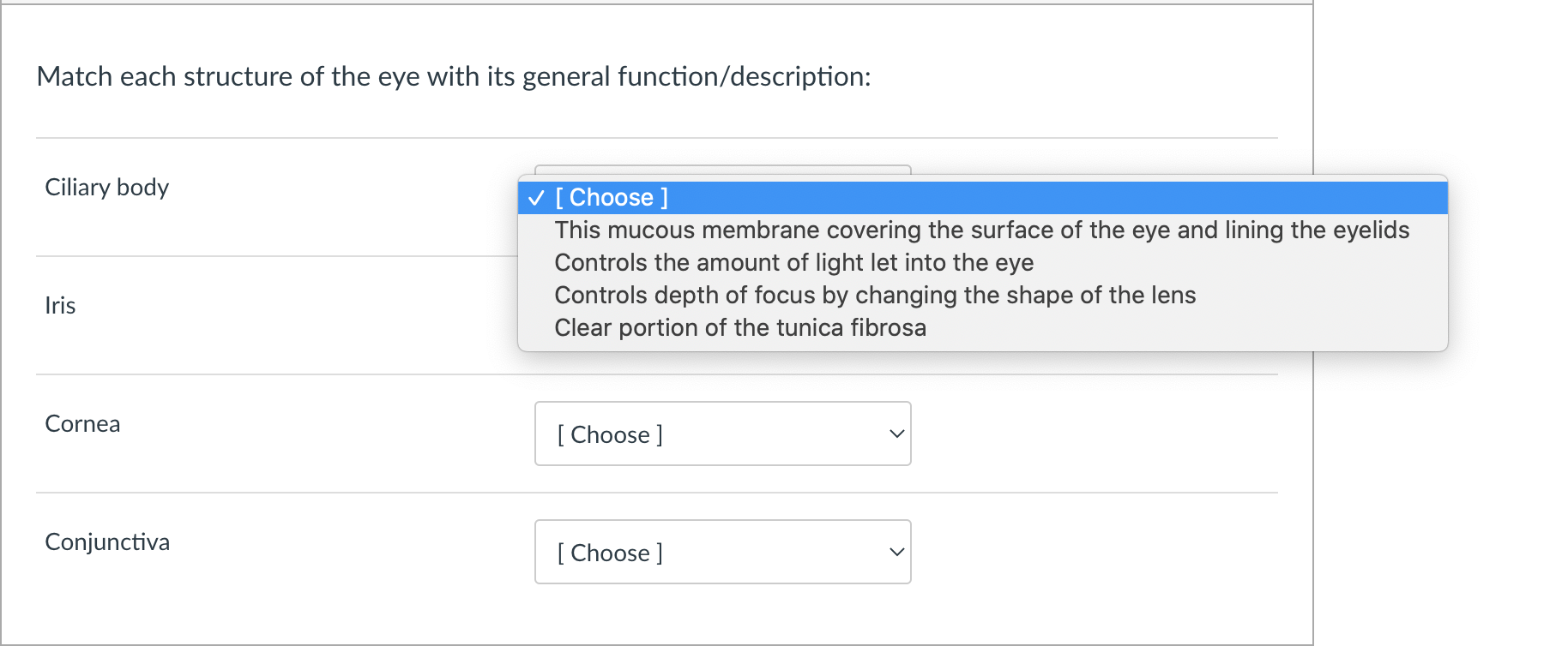 Solved Match each structure of the eye with its general | Chegg.com