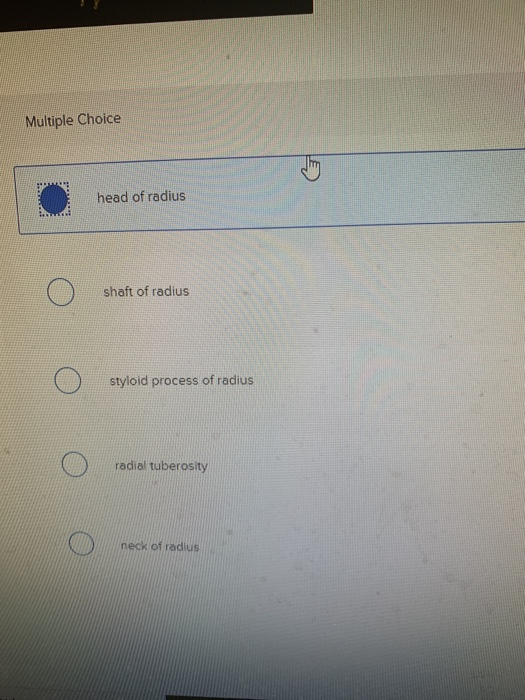 Solved Which structure is highlighted? Multiple Choice | Chegg.com