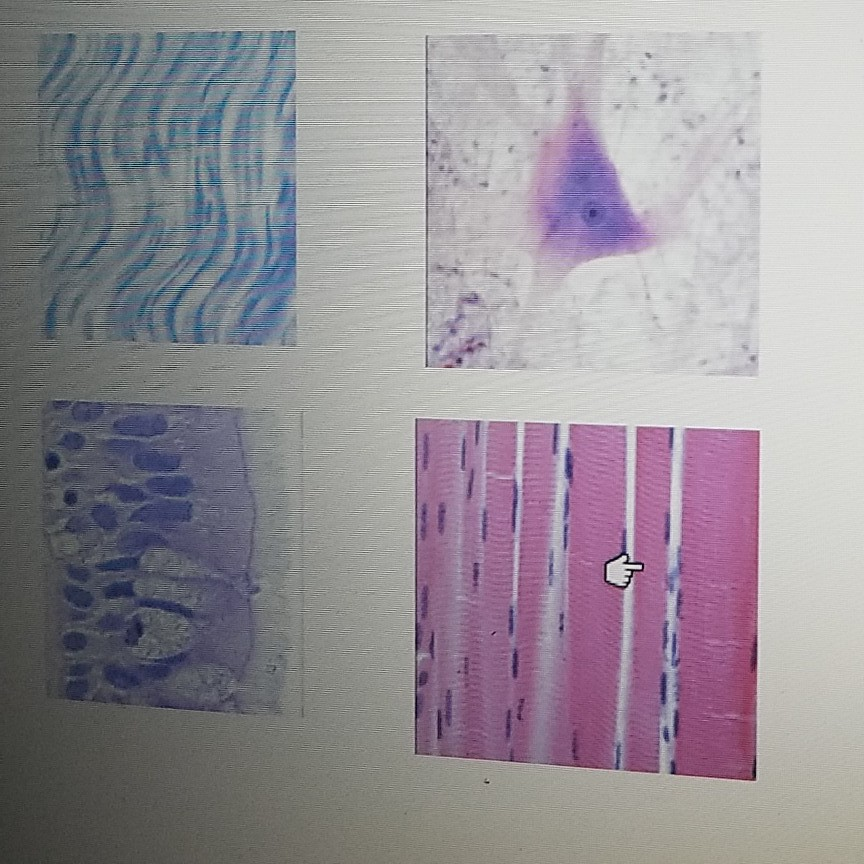 Put These Answers With Correct Tissue Comprises