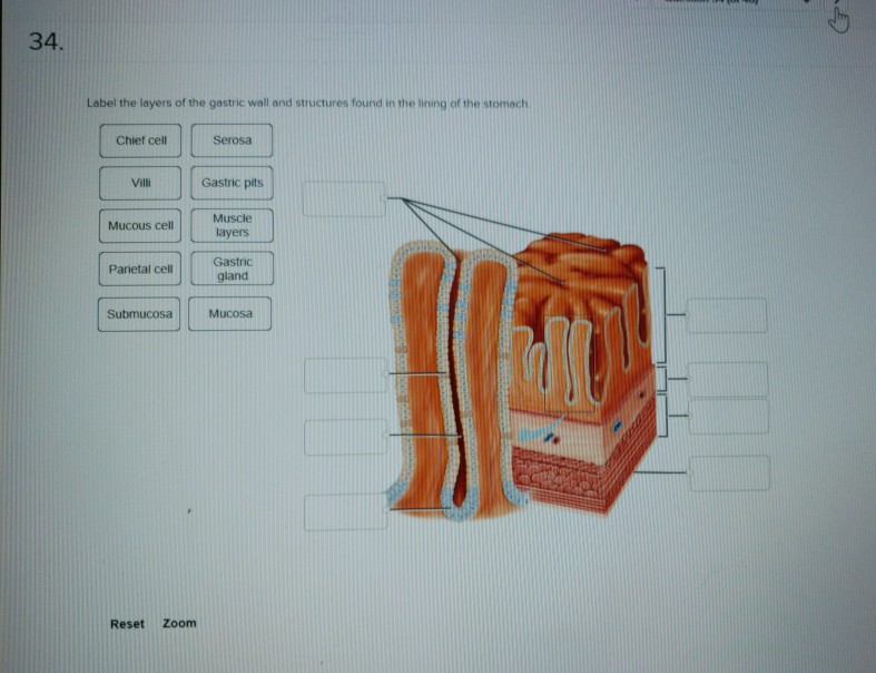 Solved 34 Label The Layers Of The Gastric Wall And