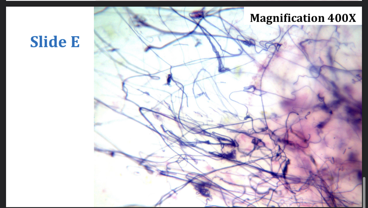 Solved ACTIVITY 3: THE CELLS OF THE CONNECTIVE TISSUES Title | Chegg.com