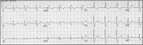 Solved To complete, use Dubin’s algorithm in this sequence: | Chegg.com