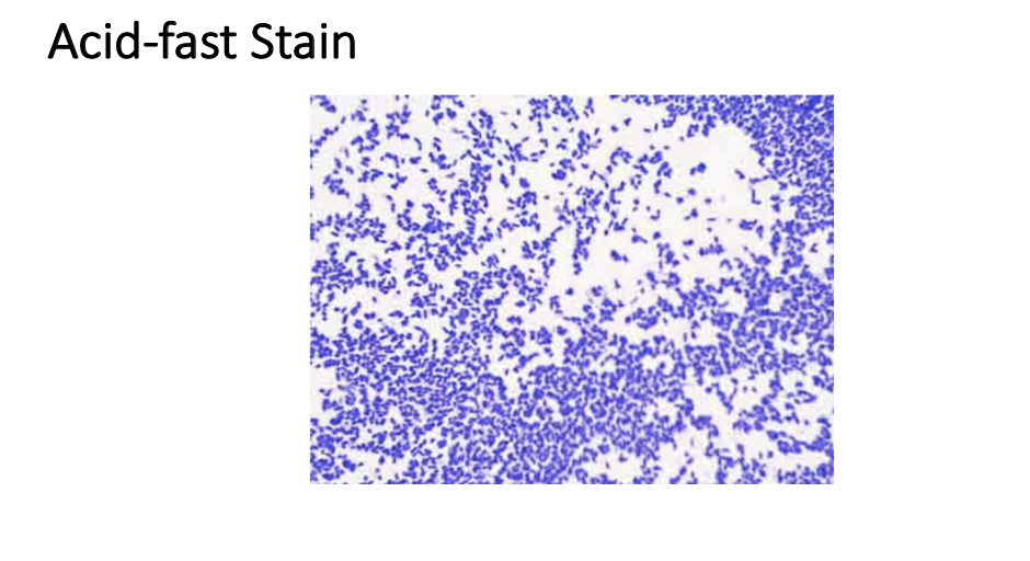 Solved Give an example of a type of a clinically important | Chegg.com