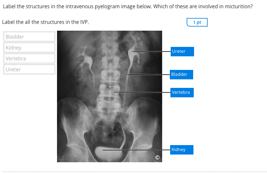 Solved Label the structures in the intravenous pyelogram | Chegg.com