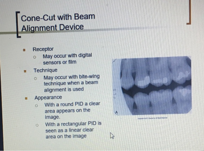 What Is The Purpose Of A Beam Alignment Device - The Best Picture Of Beam