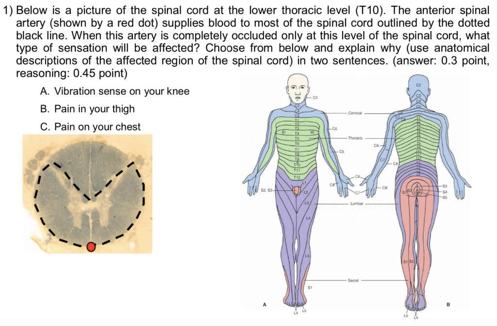Solved 1) Below is a picture of the spinal cord at the lower | Chegg.com
