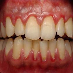 Solved (dental hygiene related) ﻿please provide a detailed | Chegg.com