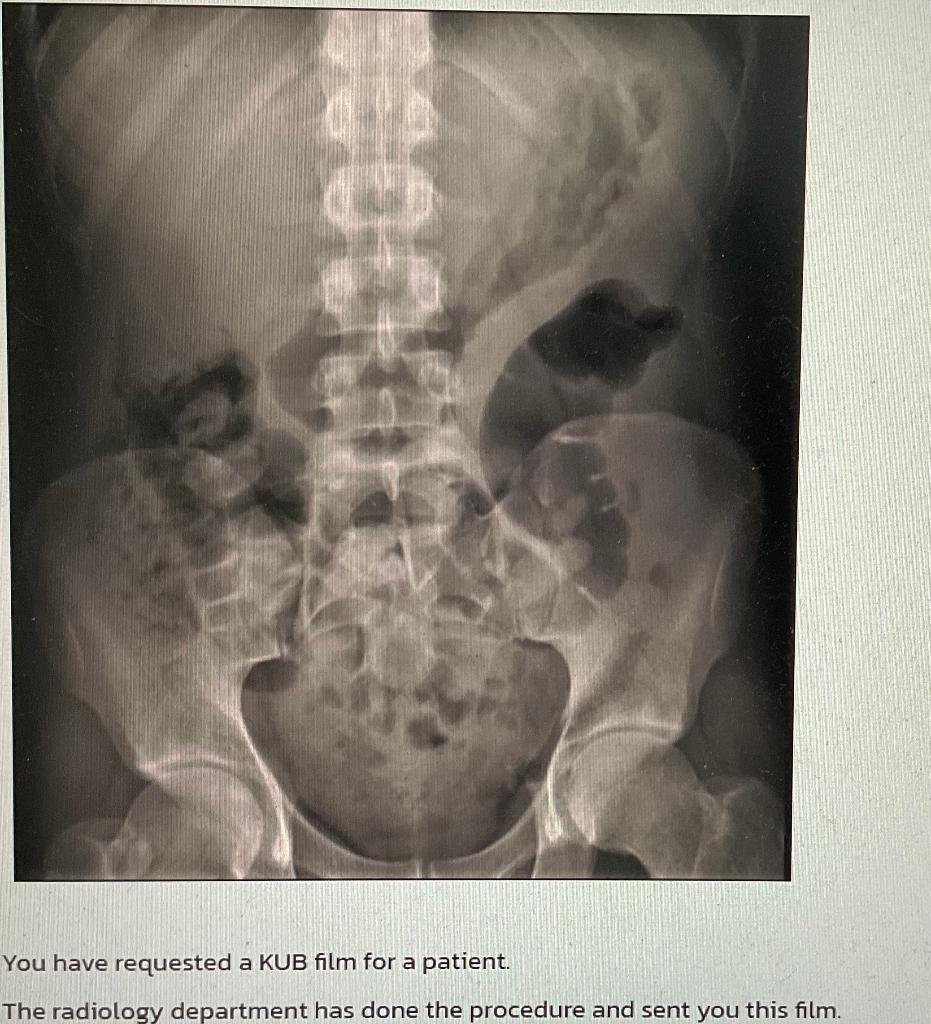 Solved You have requested a KUB film for a patient. The | Chegg.com