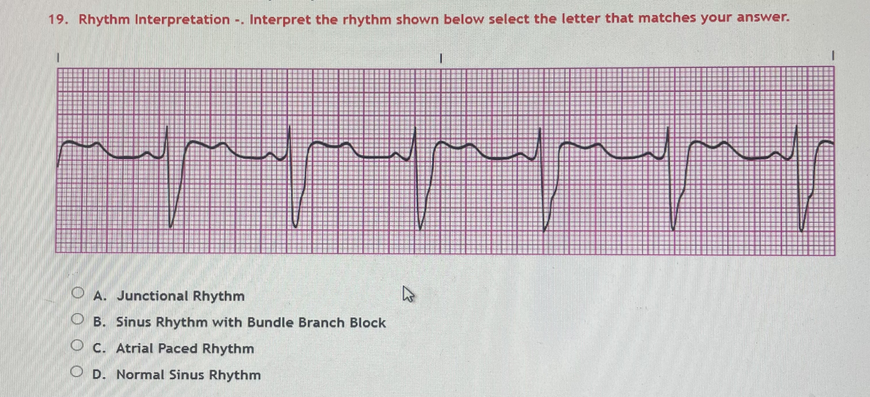 Solved 19. ﻿Rhythm Interpretation -. ﻿Interpret the rhythm | Chegg.com