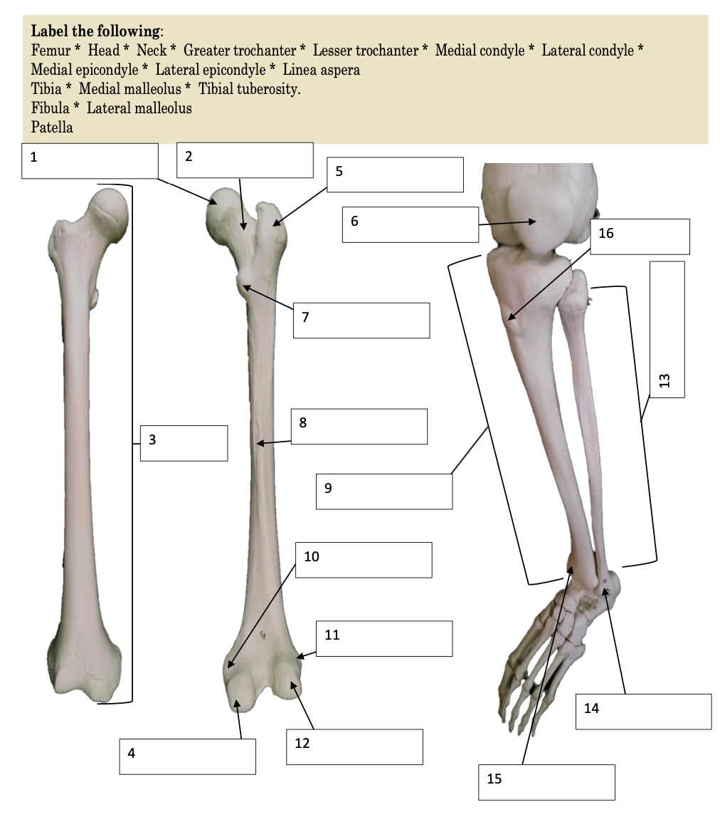 Solved Label the following: Scapula : Spine * Coracoid | Chegg.com