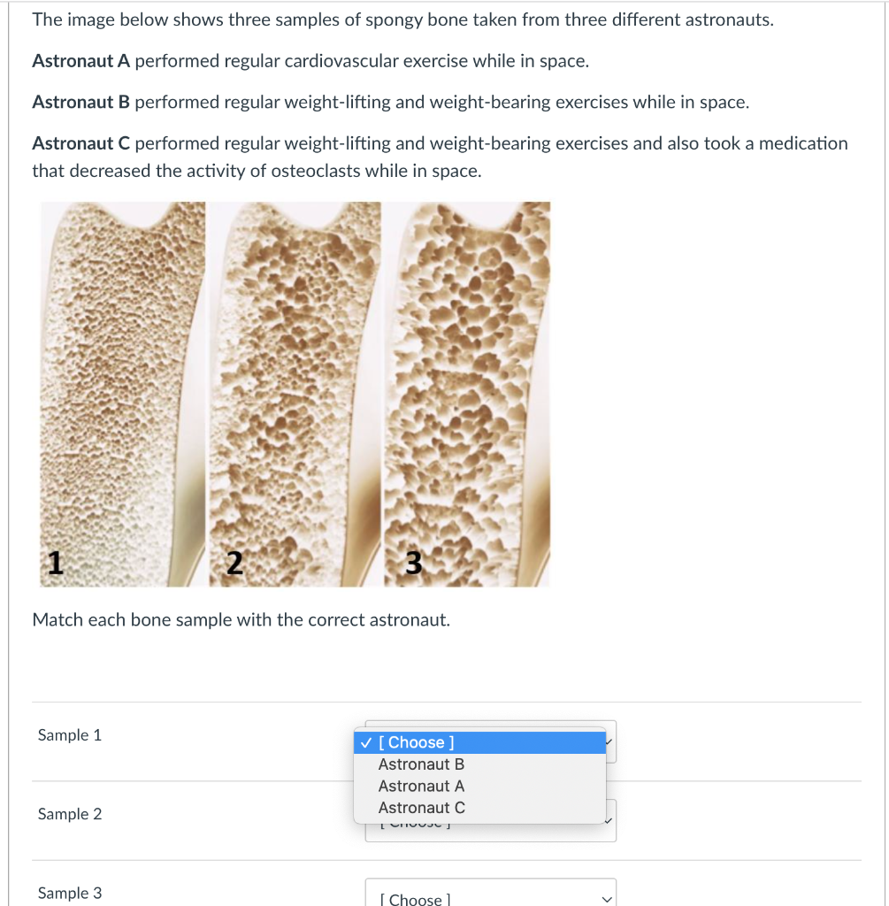 Solved The image below shows three samples of spongy bone | Chegg.com