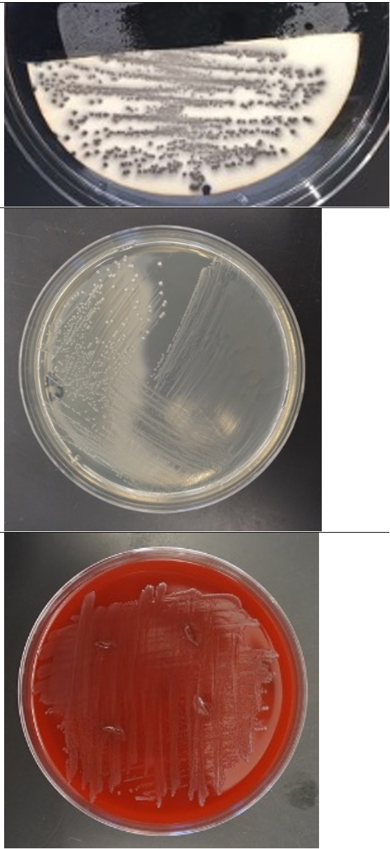 Solved I need help identifying the unknown bacterium, by | Chegg.com