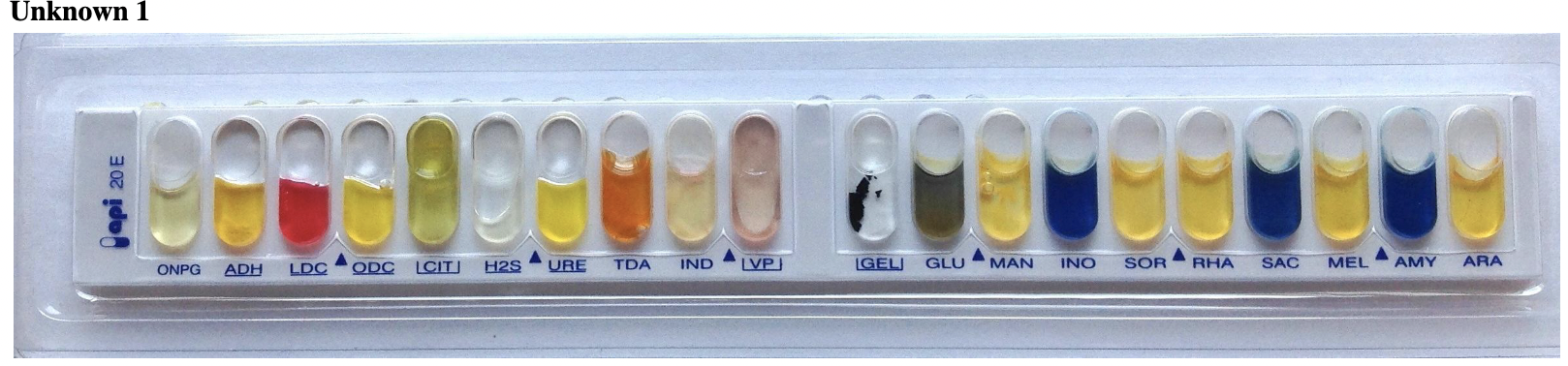 Solved Find all 3 unknowns from API 20 E strip (7 digit code | Chegg.com