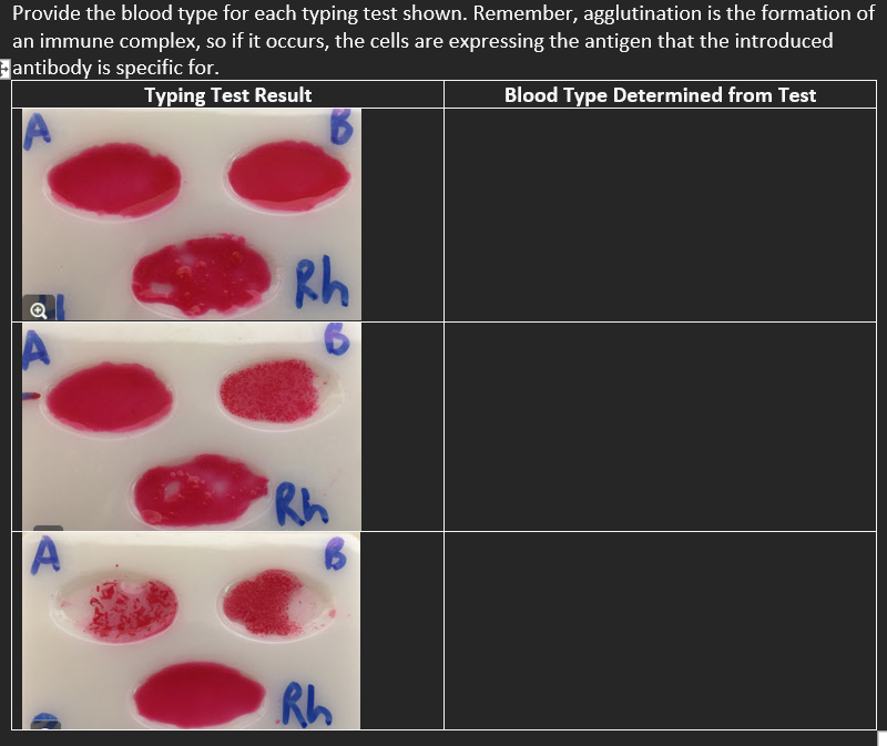 Solved Provide the blood type for each typing test shown. | Chegg.com