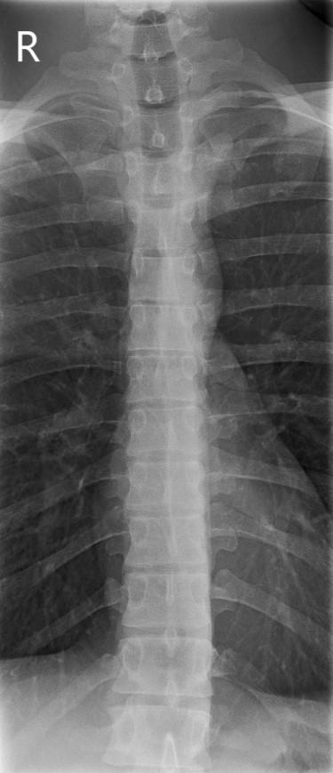 Solved 3. Locate the right L4 pedicle. 4. Locate the left | Chegg.com