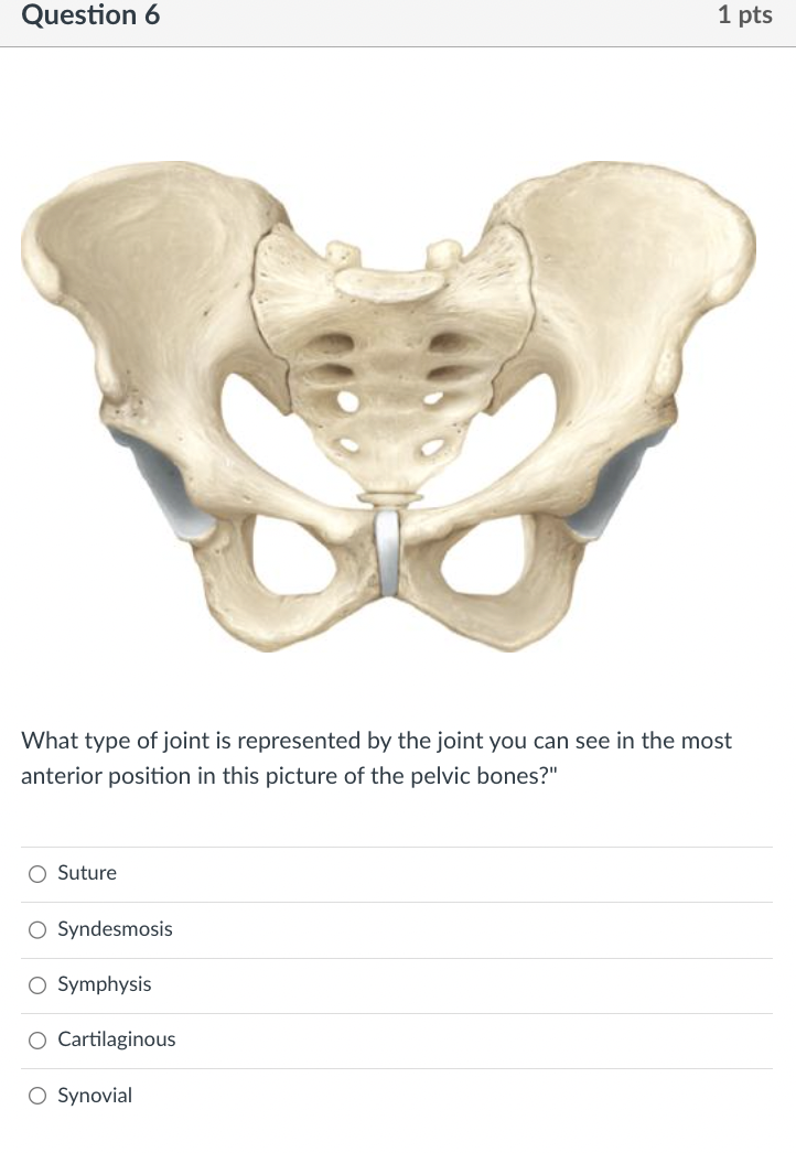 Solved Question 6What type of joint is represented by the | Chegg.com