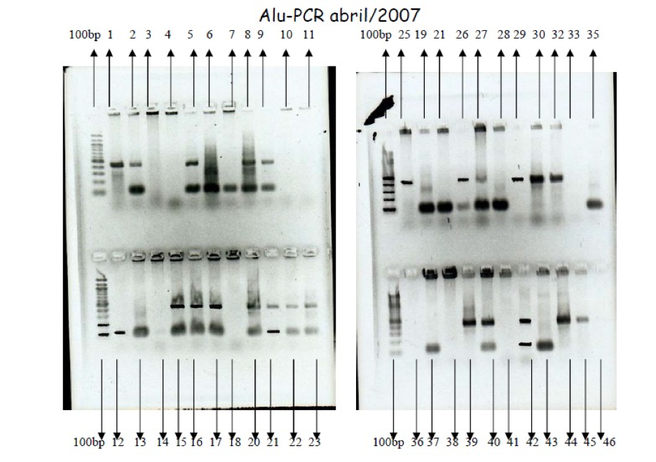 Solved Alu-PCR abril/2007 2 3 4 5 6 7 8 9 10 11 100bp 25 19 | Chegg.com