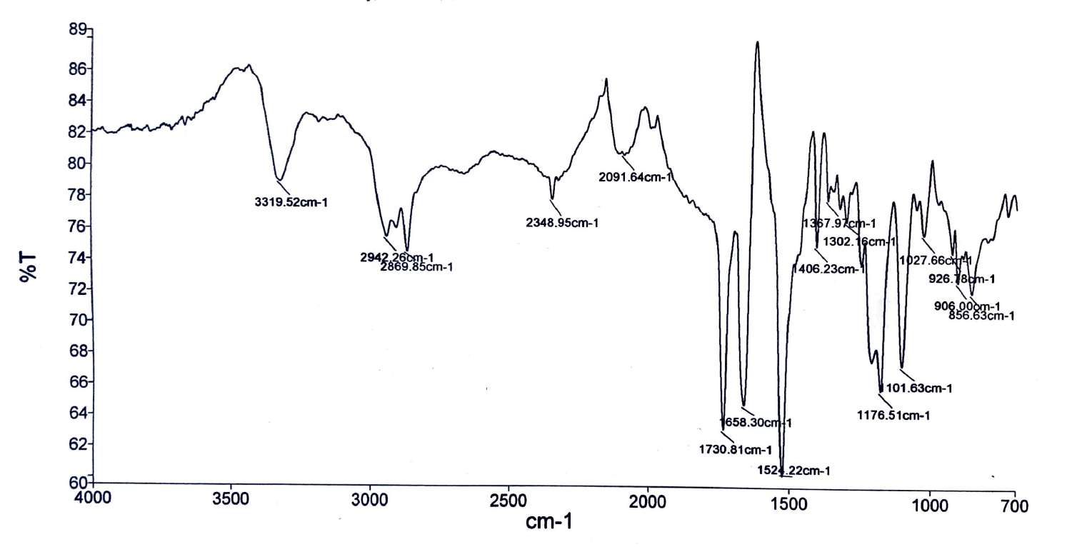 Solved Identify any significant peaks in the IR spectrum and | Chegg.com