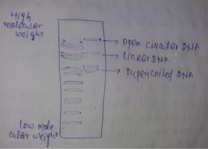 Solved In the following picture of a plasmid DNA sample run | Chegg.com