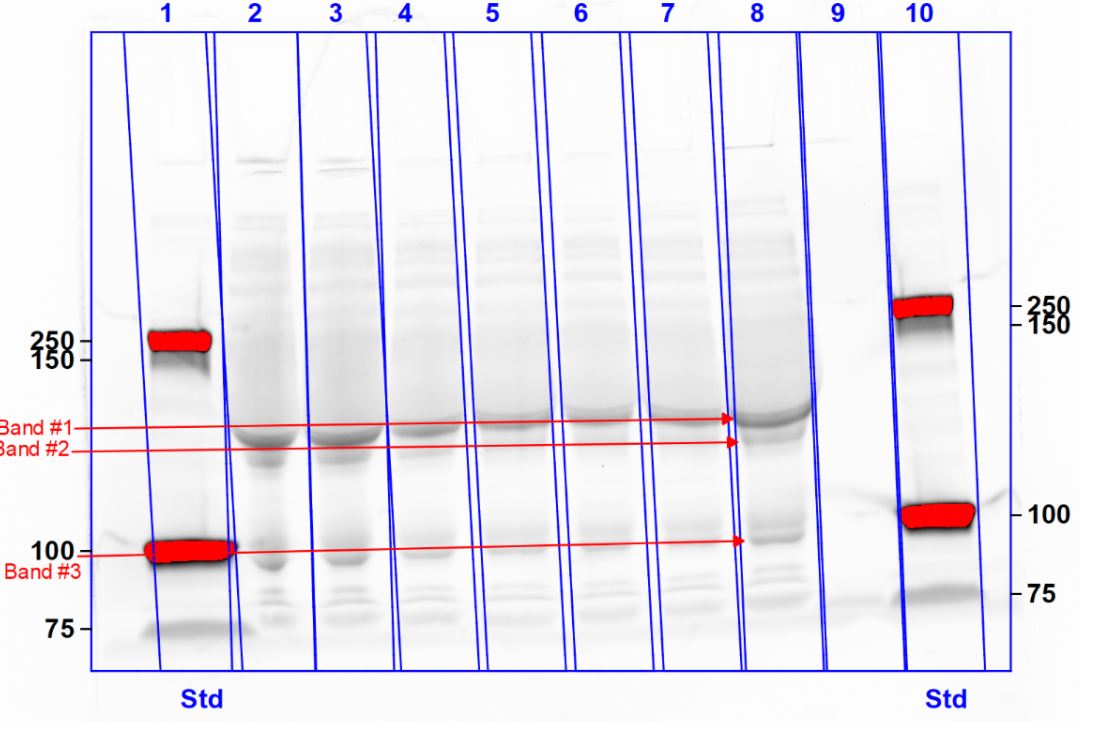 What are the identities of the 3 protein bands in | Chegg.com