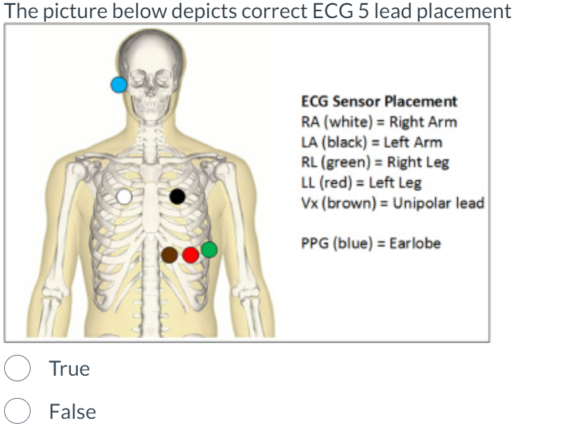Solved The picture below depicts correct ECG 5 ﻿lead | Chegg.com