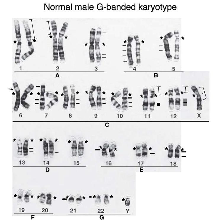 Solved Examine the normal G-banded karyotype provided. a) | Chegg.com